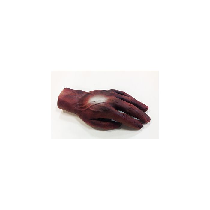 Simulaids Burn Hand 2Nd & 3Rd Degree African-American - SAVELIVES