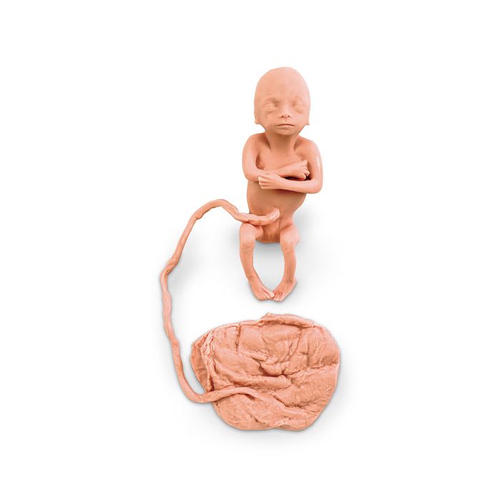 Fetus, 5 Months, Female - SAVELIVES