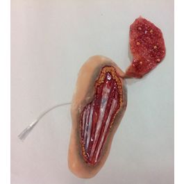 Simulaids Xtreme Forearm Avulsion With Flap - SAVELIVES