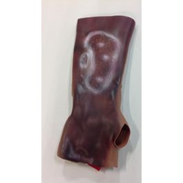 Simulaids Burn Forearm 2Nd & 3Rd Degree African-American - SAVELIVES