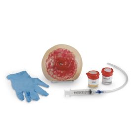 Model, Ostomy/infected - SAVELIVES