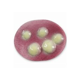 Simulaids Mustard Gas Blister (Multi) - SAVELIVES